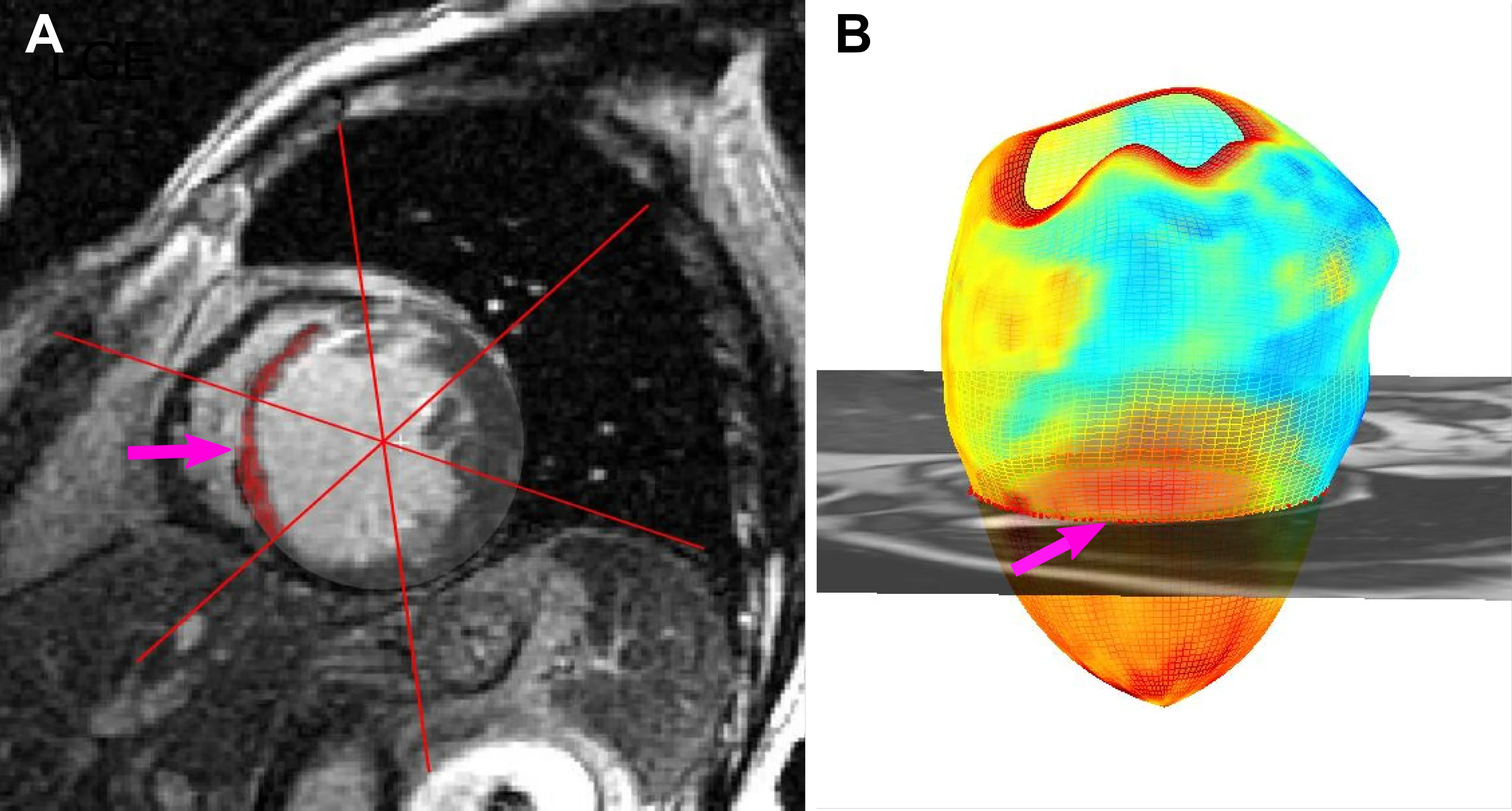 AsianCardiac | Engineering Better Cardiovascular Health