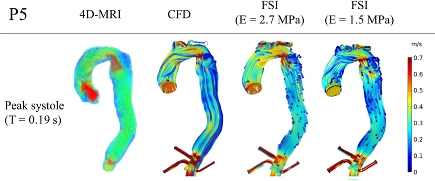 AsianCardiac | Engineering Better Cardiovascular Health